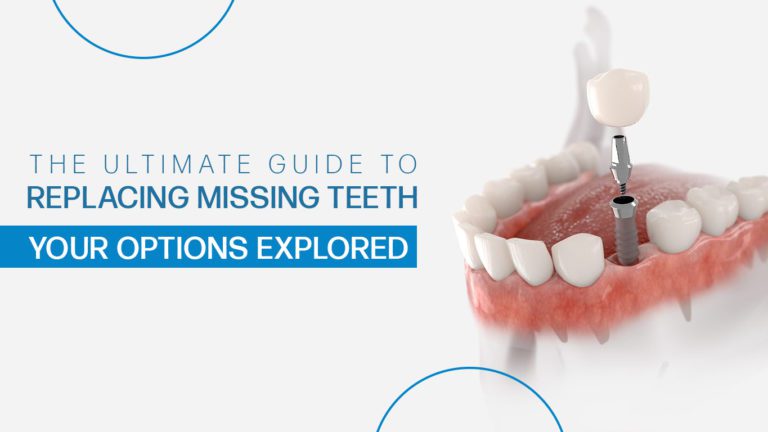 Guide to Replacing Missing Teeth by Springvale Dental Clinic