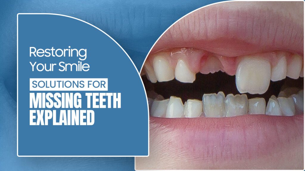 Restoring Your Smile: Effective Solutions for Missing Teeth