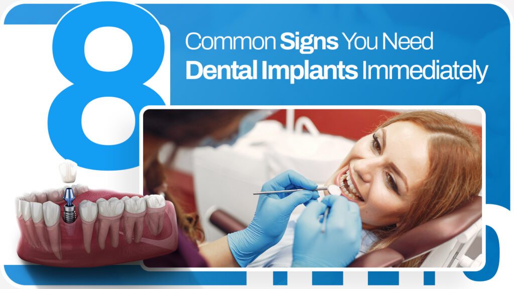 8 Signs You Need Dental Implants - Restore Your Smile Today