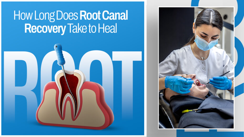 Root Canal Recovery Guide: Timeline & Tips | Springvale Dental