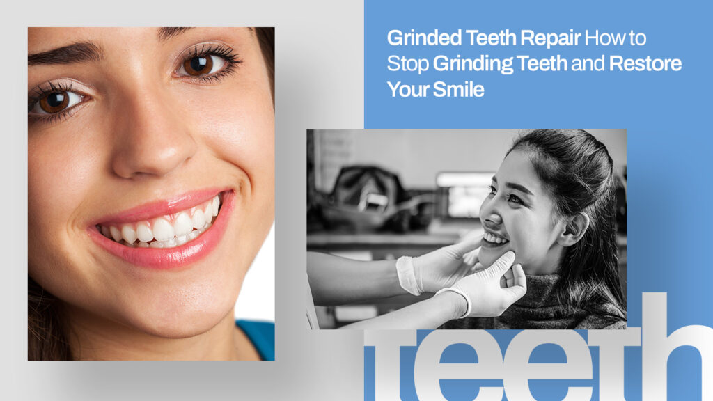 Grinded teeth repair: How To Stop Grinding Teeth