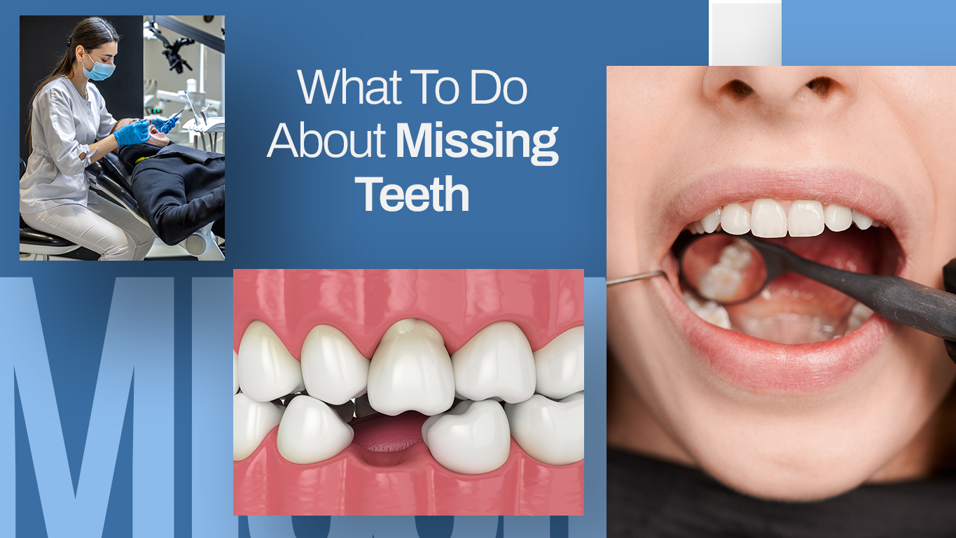 What to Do About Missing Teeth: Best Solutions