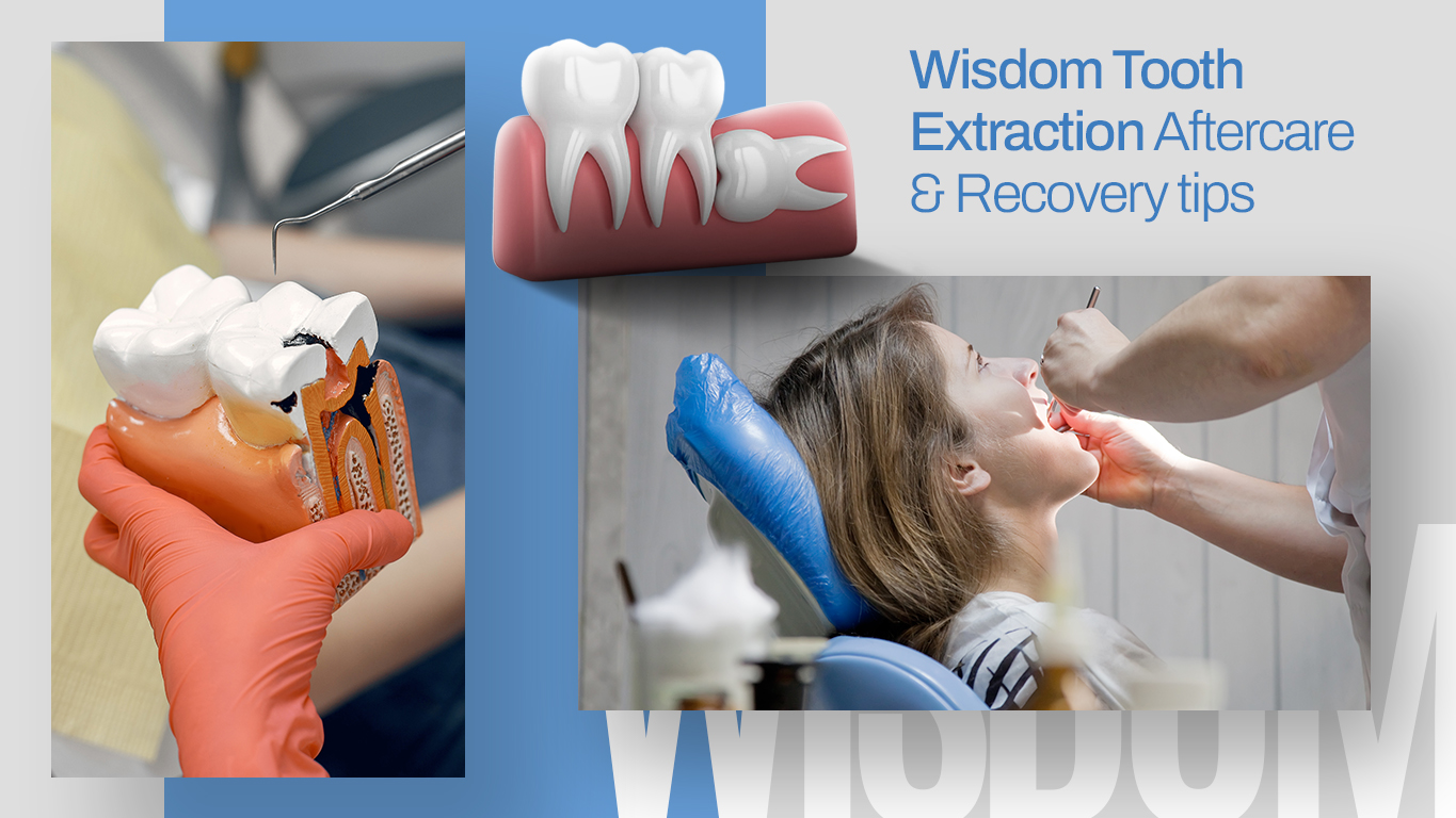 Wisdom Tooth Extraction Aftercare & Recovery Tips